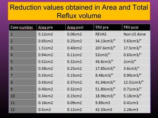 Area reduction in superficial venous insuffiency treatment | PPT