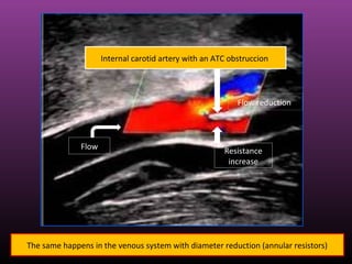 Area reduction in superficial venous insuffiency treatment | PPT