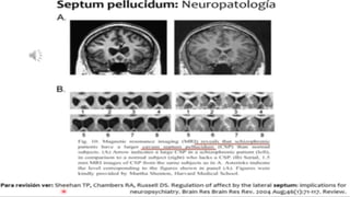 Area septal del sistema limbico | PPT
