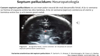 Area septal del sistema limbico | PPT
