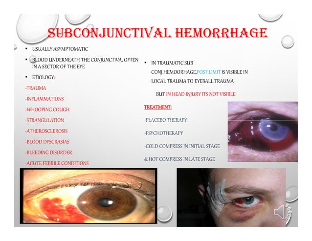 A review of red eye by manojit | PPT