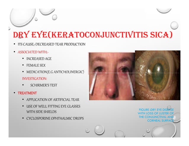 A review of red eye by manojit | PPT