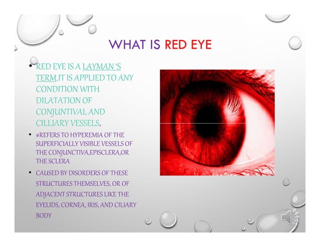 A review of red eye by manojit | PPT