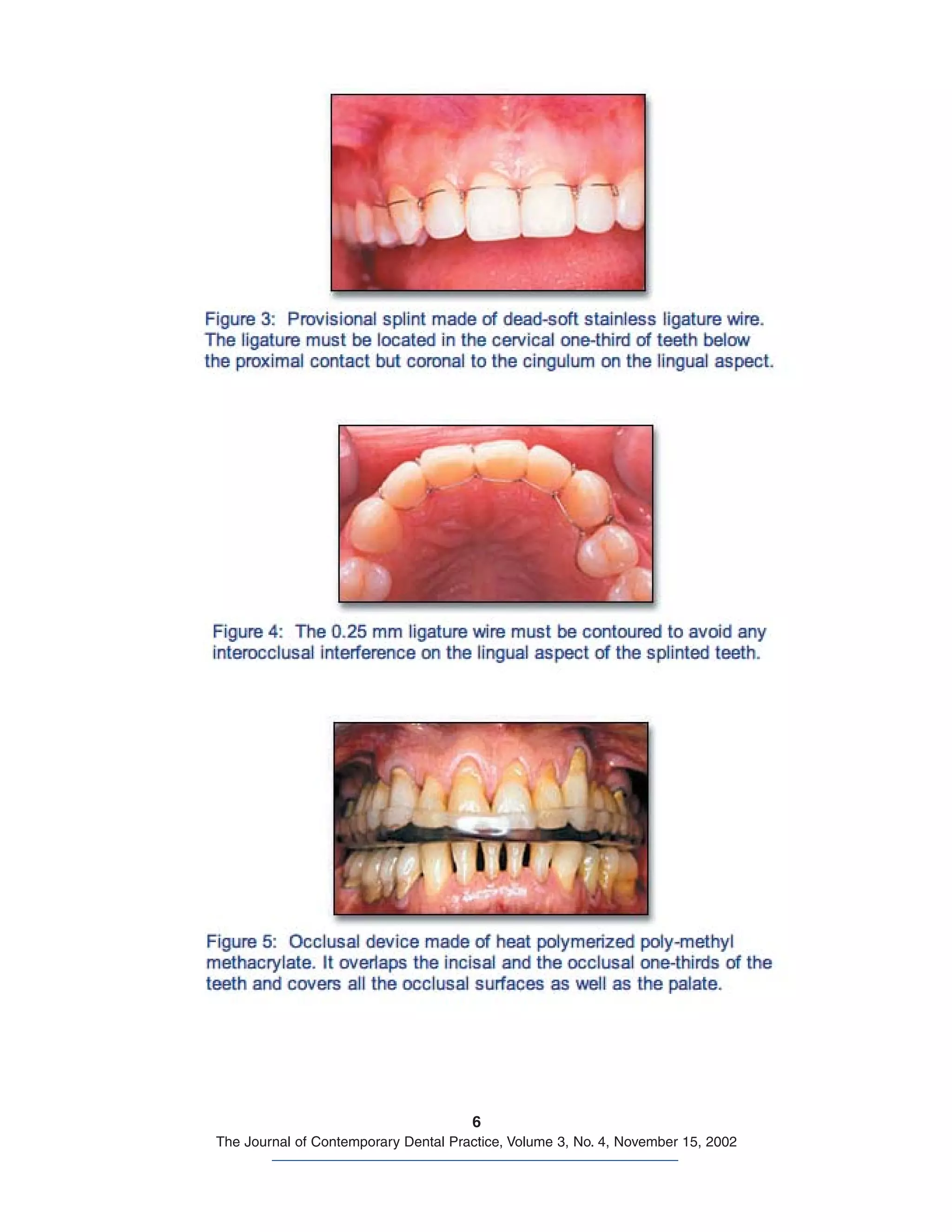 A+review+of+the+clinical+management+of+mobile+teeth | PDF