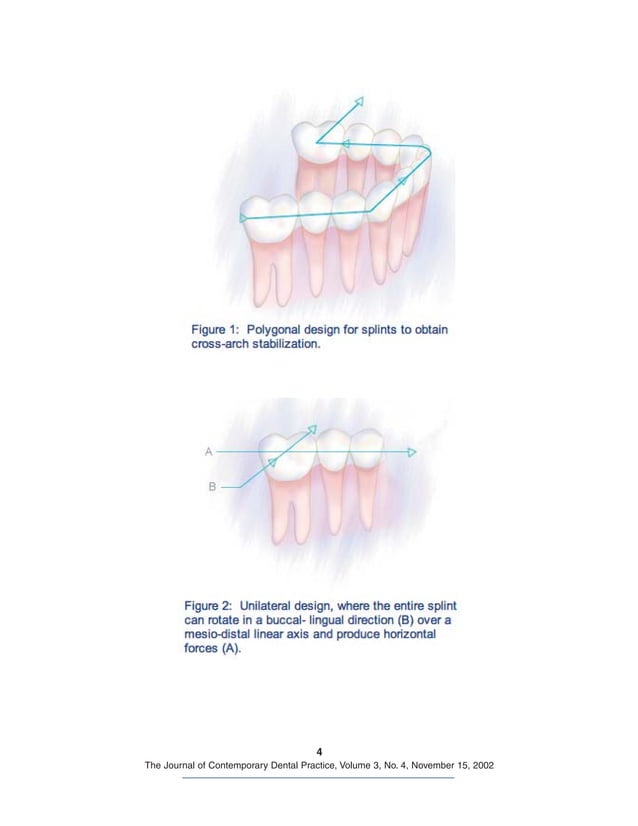 A+review+of+the+clinical+management+of+mobile+teeth | PDF