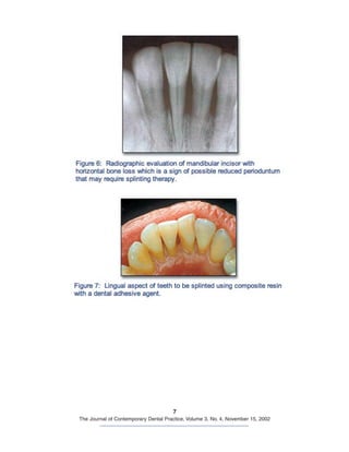 A+review+of+the+clinical+management+of+mobile+teeth | PDF