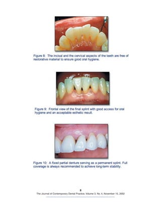A+review+of+the+clinical+management+of+mobile+teeth | PDF