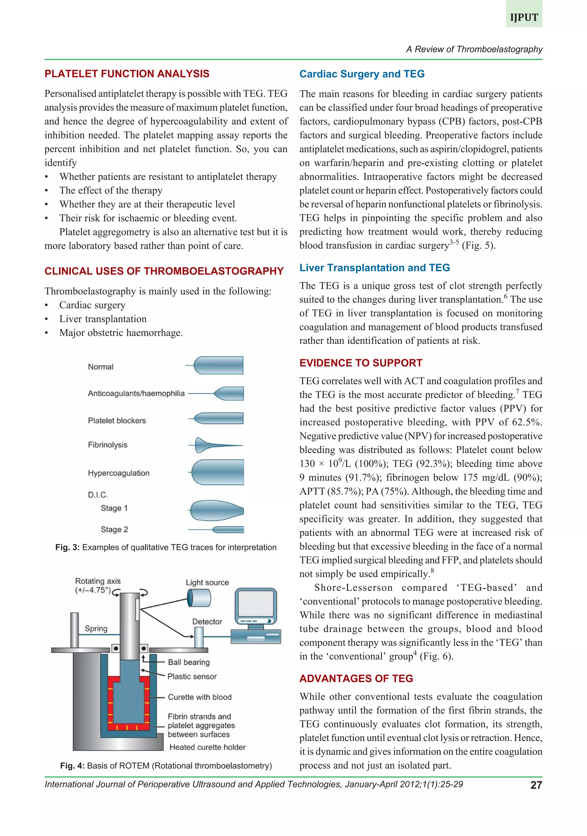 A review of thromboelastography | PDF