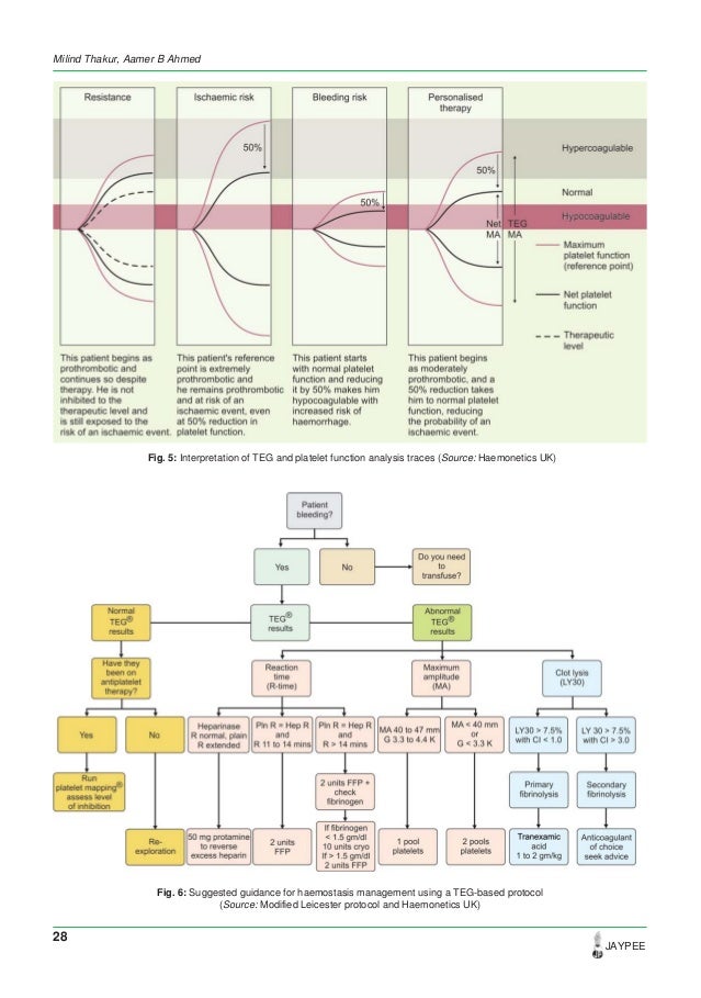 A review of thromboelastography