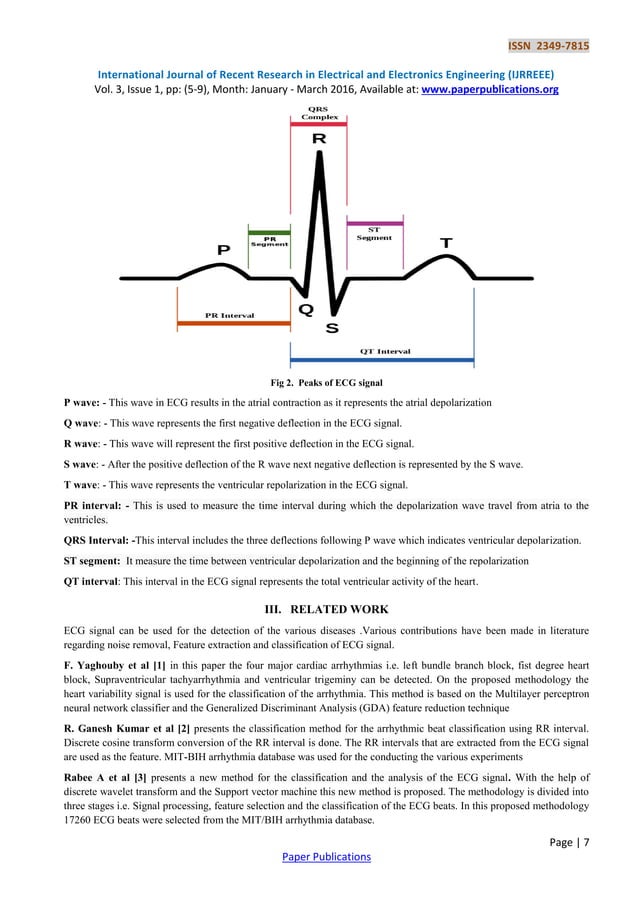 A Review on Arrhythmia Detection Using ECG Signal | PDF