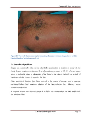 Dengue fever | DOCX