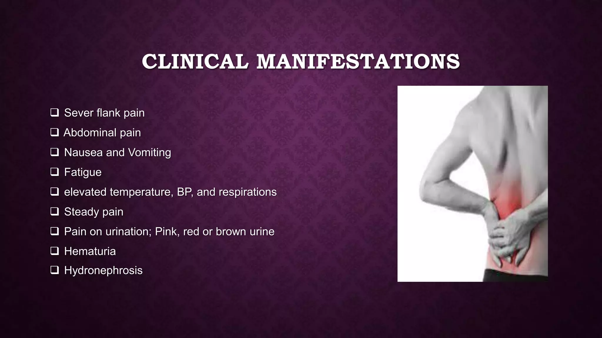 A review on kidney stone disease ppt | PPTX