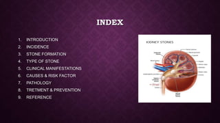 A review on kidney stone disease ppt | PPTX