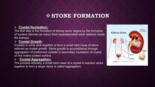 A review on kidney stone disease ppt | PPTX