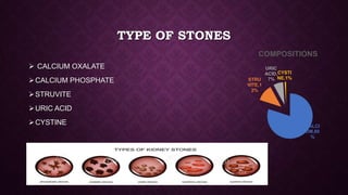 A review on kidney stone disease ppt | PPTX