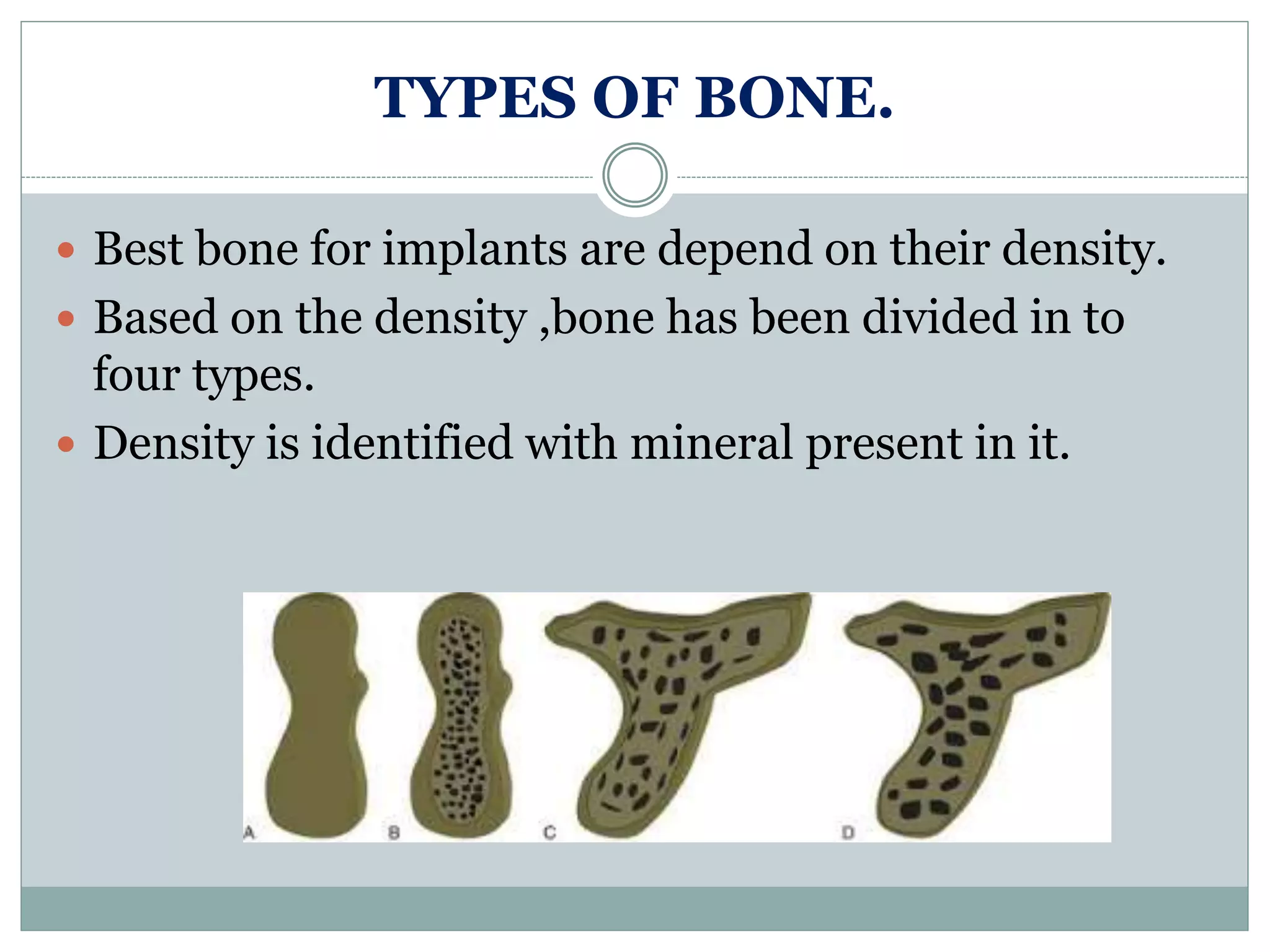 Are your bone is fit for dental implants | PPTX