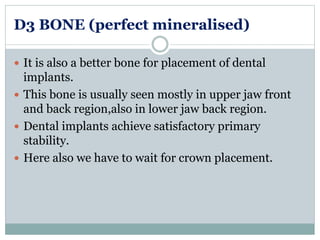Are your bone is fit for dental implants | PPTX