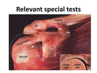 Glenohumeral Ligament Cadaver