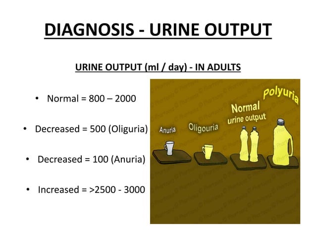 Acute Renal Failure Overview acute-renal-failure-overview
