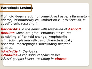 Acute Rheumatic Fever | PPT