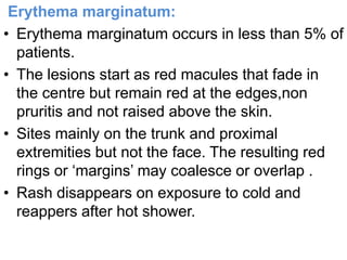 Acute rheumatic fever.pptx