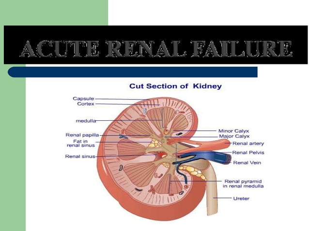 Acute Renal failure | PPT