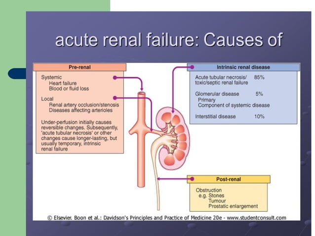 Acute Renal failure | PPT