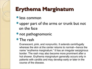 Erythema Marginatum Rheumatic Fever