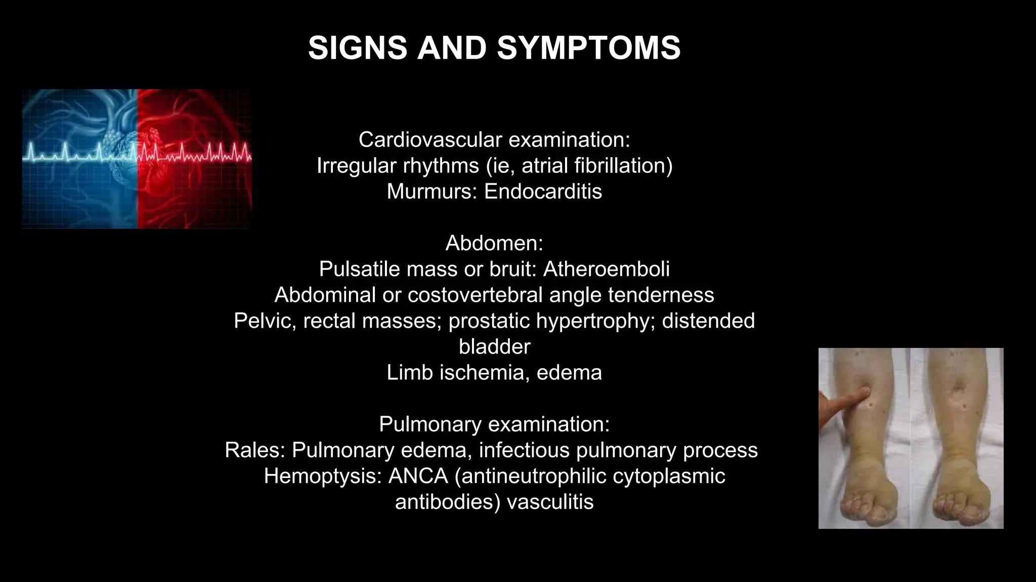 Acute Renal Failure | PPTX