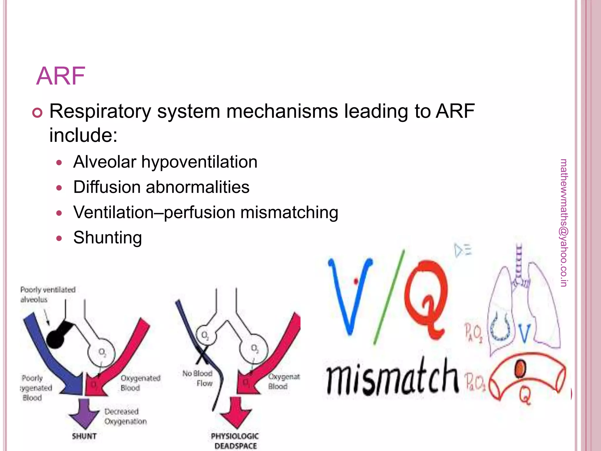 Acute Respiratory failure | PPTX