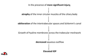 Angle Recession Glaucoma | PPT