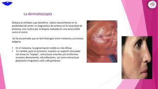 Discromías Exógenas, un enfoque en Dermatología | PPTX