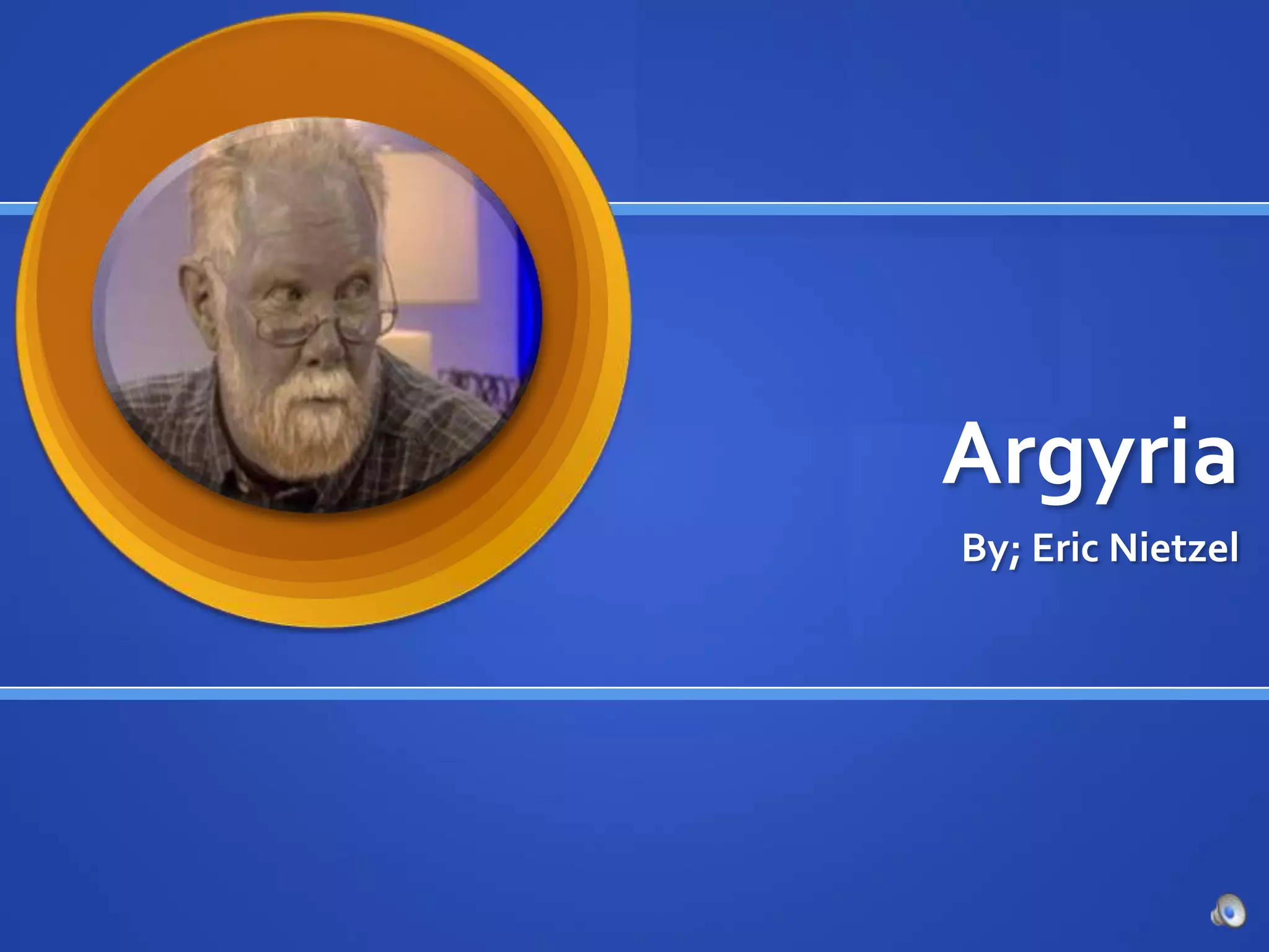 Everything You Need to Know About Argyria | PPT