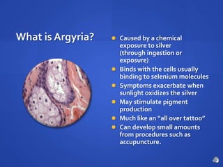 Argyria | PPTX