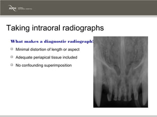 ARH Dental Radiology Workshop | PPT | Dental Health | Diseases and ...