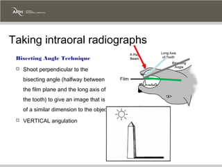 ARH Dental Radiology Workshop | PPT | Dental Health | Diseases and ...