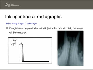 ARH Dental Radiology Workshop | PPT | Dental Health | Diseases and ...