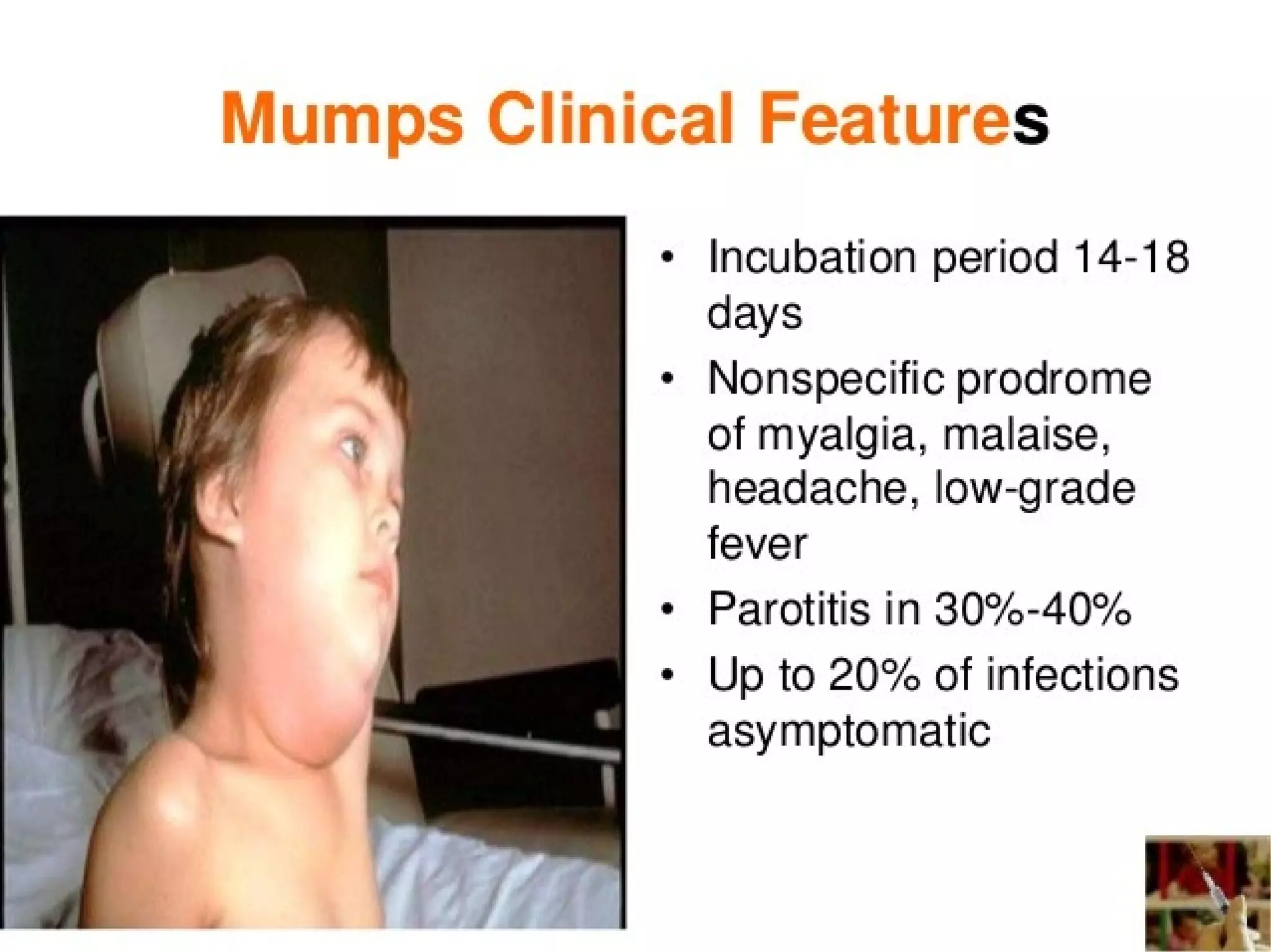 Acute respiratory infection (ARI) | ODP