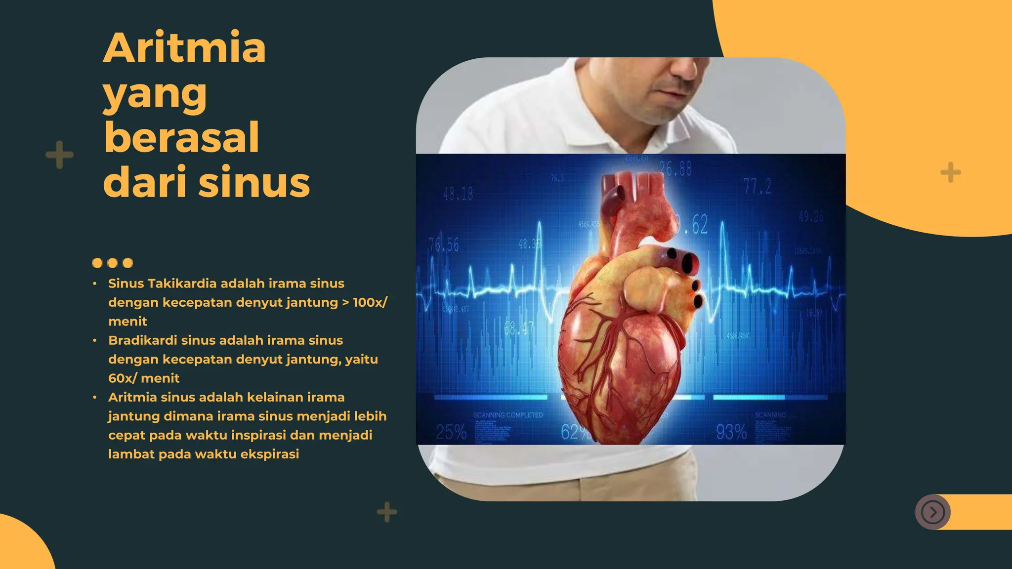Aritmia pengertian pencegahan tatalaksana.pptx