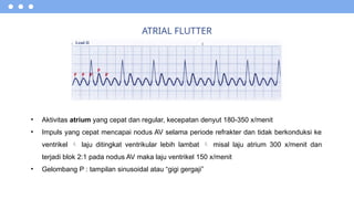pengertian dan tatalaksana pada Aritmia .pptx