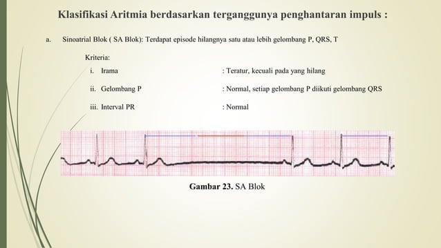 Aritmia dan AF.pptx