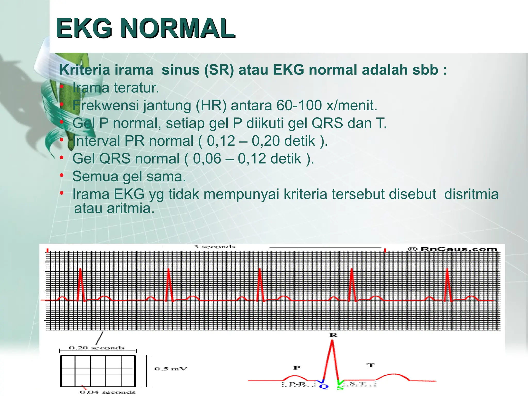 Gambaran EKG dengan Aritmia ggn pembentukan p3.ppt