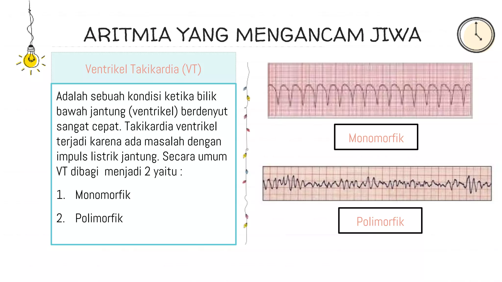Aritmia Kelompok 2.pptx