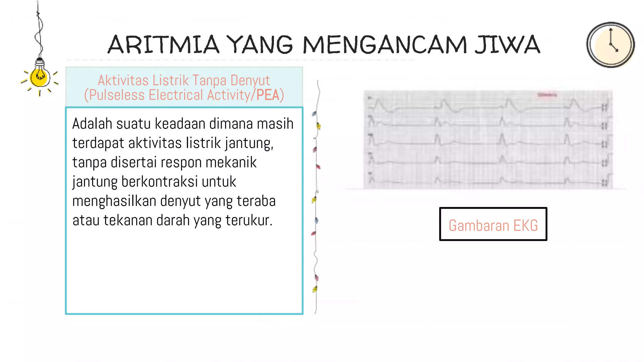 Aritmia Kelompok 2.pptx
