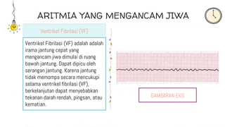 Aritmia Kelompok 2.pptx