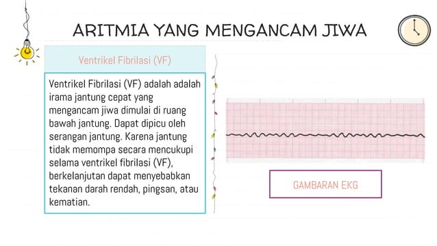 Aritmia Kelompok 2.pptx