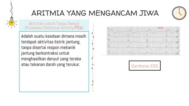 Aritmia Kelompok 2.pptx