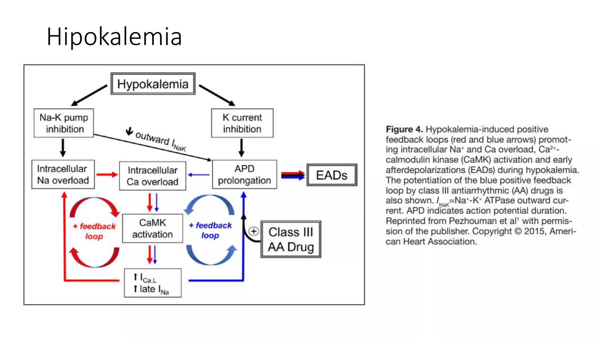 Aritmia pada Hiperkalemia dan Hipokalemia serta LQTS.pptx