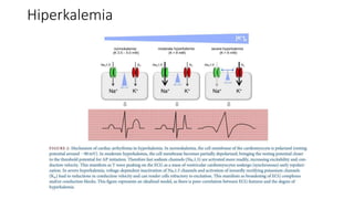 Aritmia pada Hiperkalemia dan Hipokalemia serta LQTS.pptx