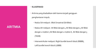 ARITMIA VENTRIKULER.pptx
